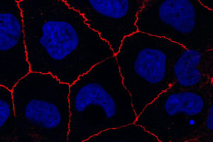 Immunostaining and Immunofluorescence | StainsFile