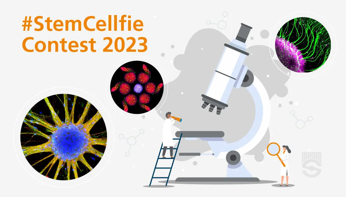 MSB for Fibrin | Stainsfile